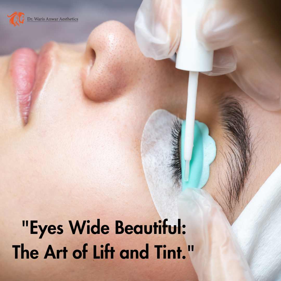 Lash Lift and Tint - Dr. Waris Anwar Aesthetics