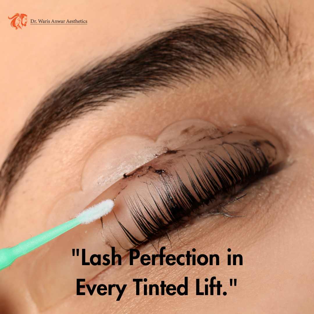 Lash Lift and Tint - Dr. Waris Anwar Aesthetics